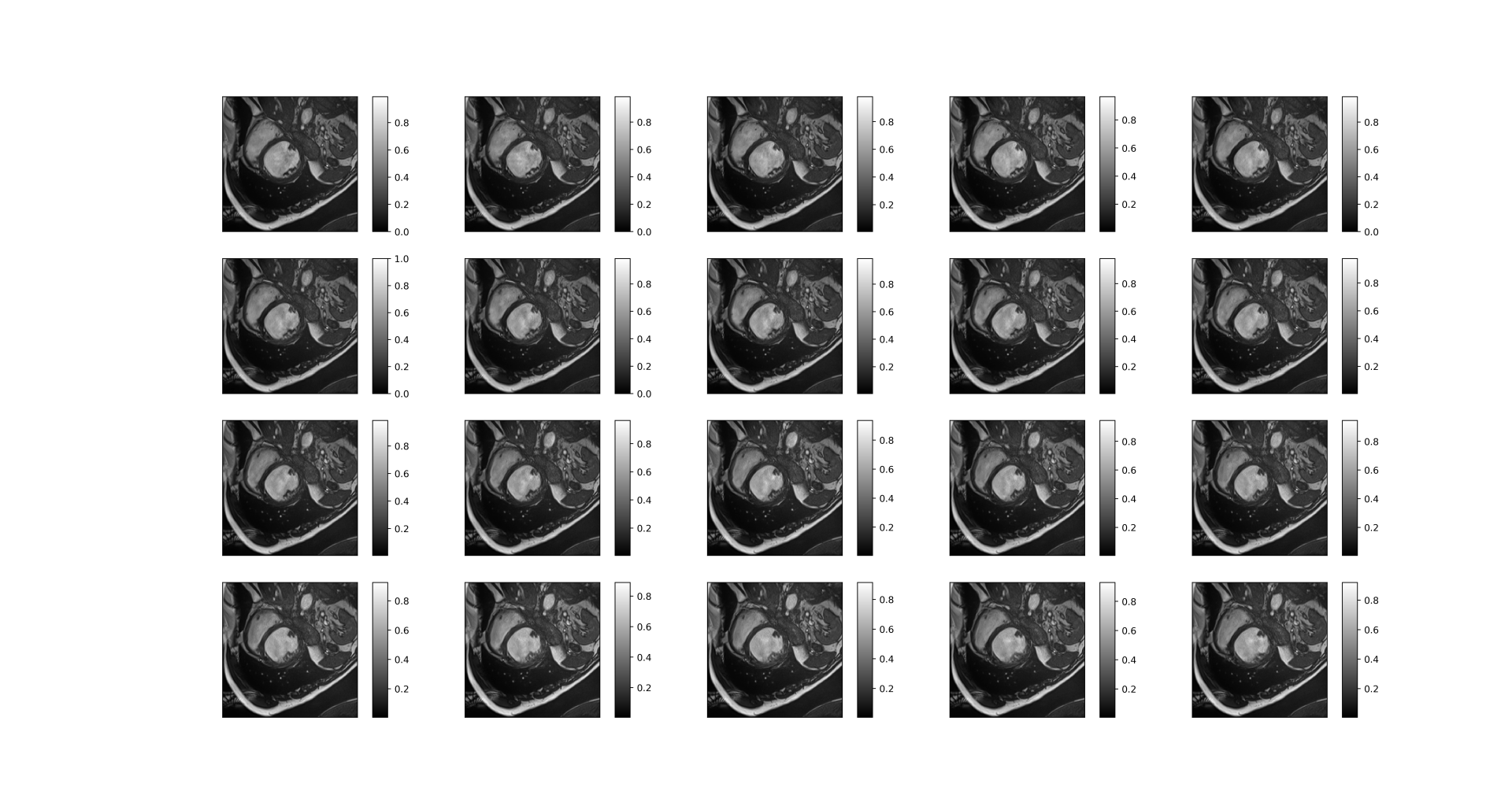 GitHub - 3b1b-sh/Deep_learning_Dynamic_MRI_Reconstruction: ShanghaiTech ...