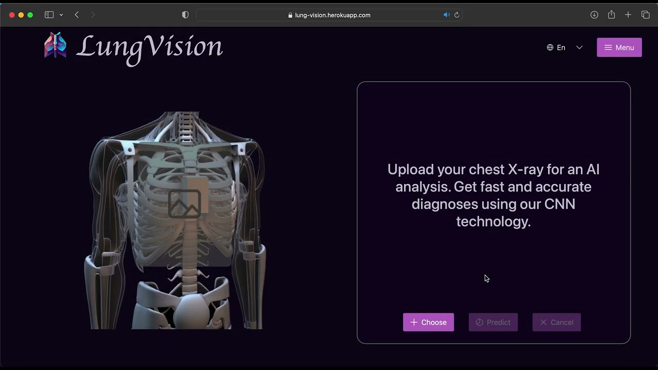 GitHub - TudorPCT/LungVision