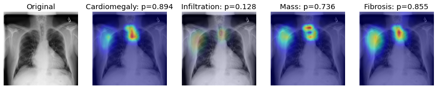 GitHub - therealnaveenkamal/Chest_XRay_Disease_Classification: This ...