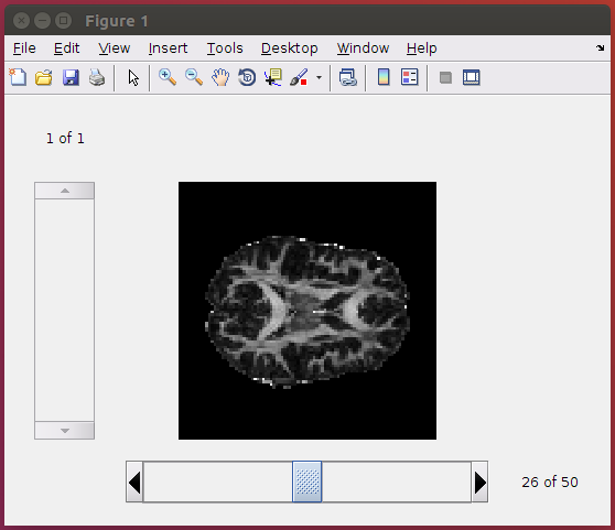 GitHub - justinblaber/nifti_utils: NIFTI utilities for MATLAB
