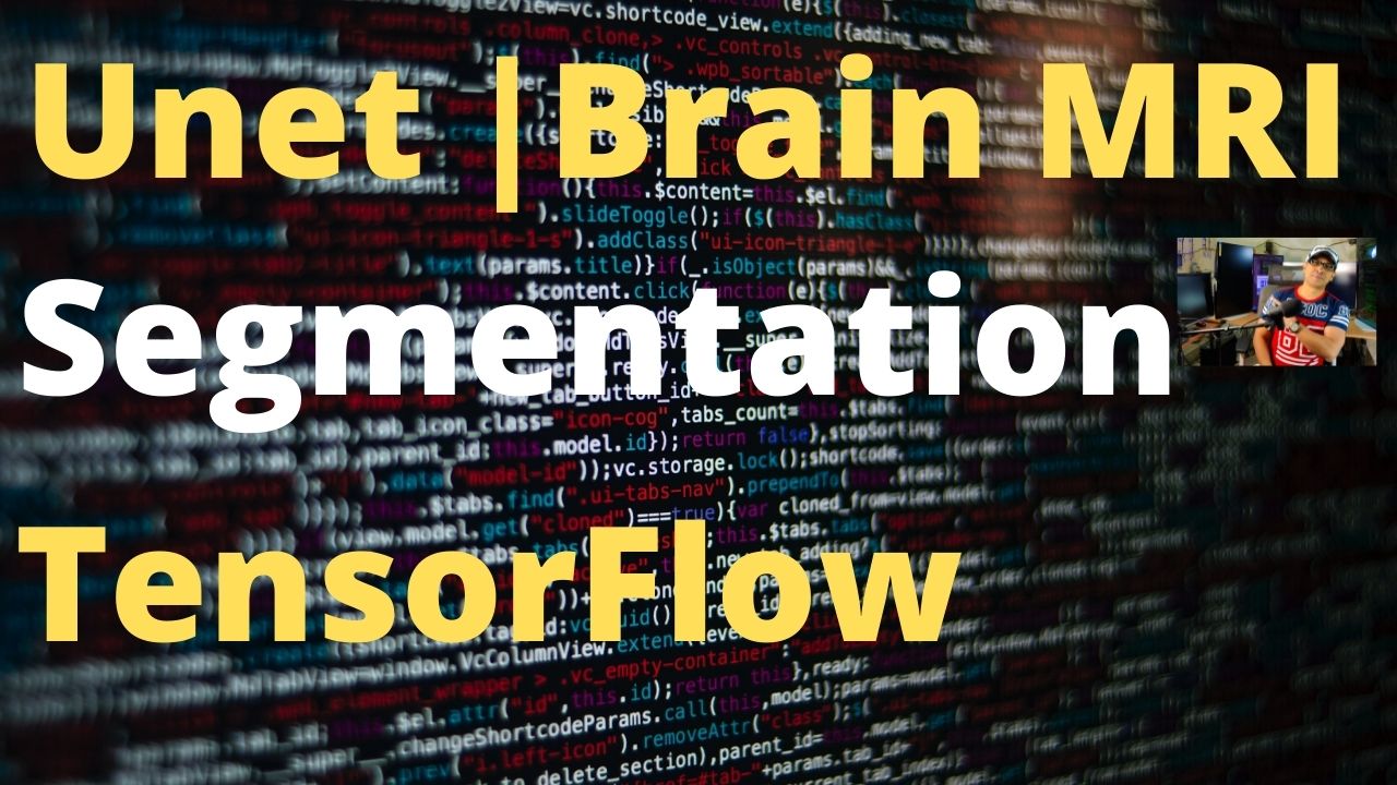 GitHub - rohan-paul/Unet-Brain-MRI-Segmentation-Tensorflow-Keras: Unet-Brain-MRI-Segmentation ...