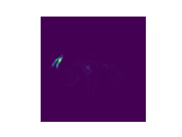 GitHub - JavisPeng/u_net_liver