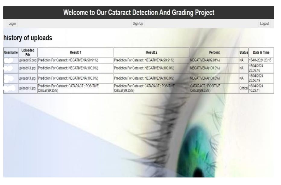 Github Raghu1134 Detection And Grading Of Cataracts Using Retinal Imaging Cataracts The