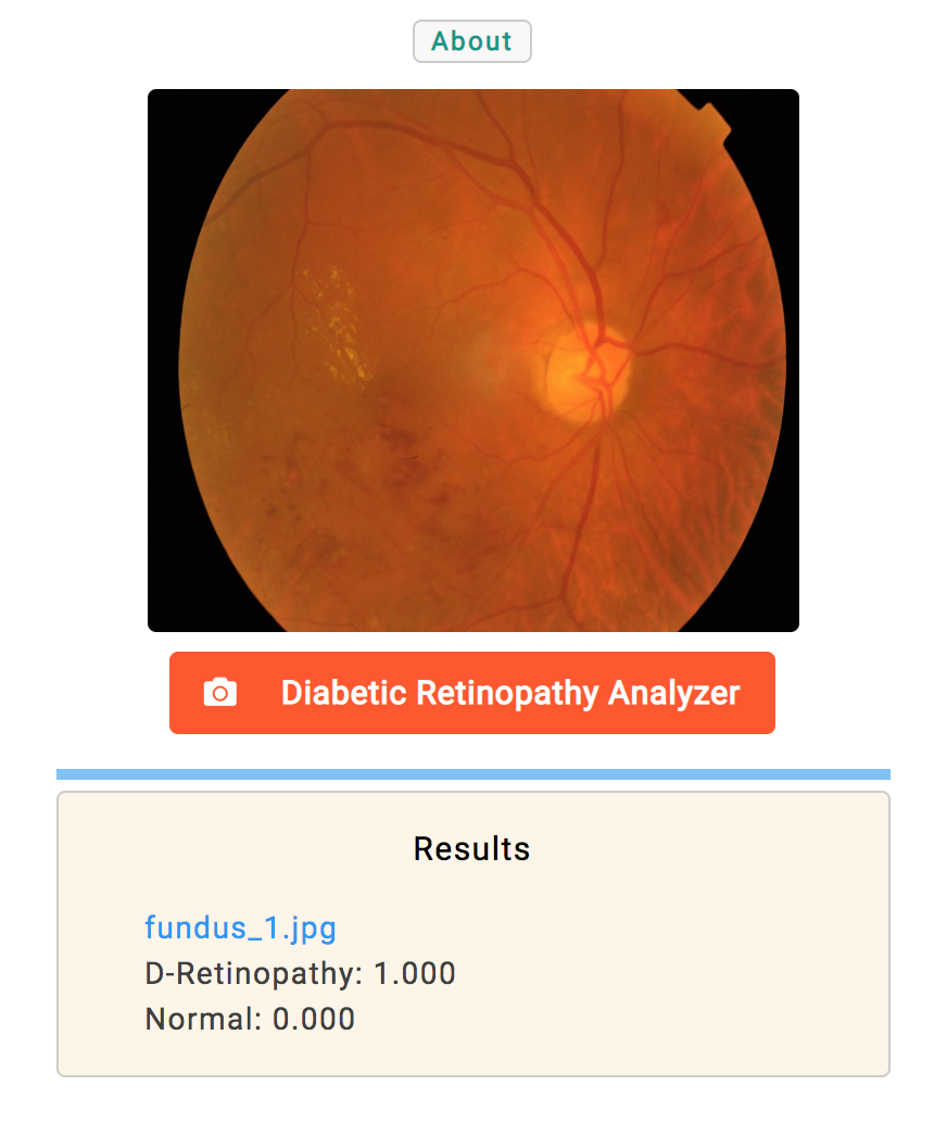 GitHub - vbookshelf/Diabetic-Retinopathy-Analyzer: Ai powered web app to detect diabetic ...