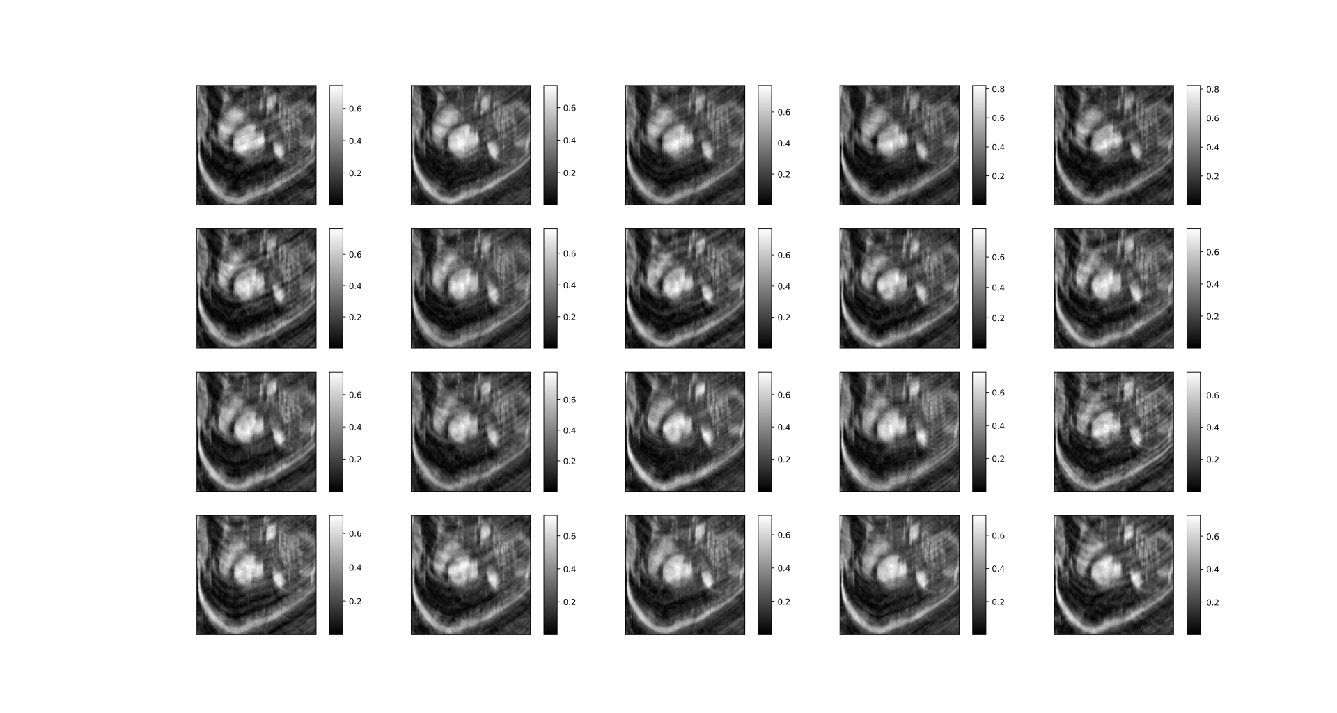 GitHub - 3b1b-sh/Deep_learning_Dynamic_MRI_Reconstruction: ShanghaiTech ...