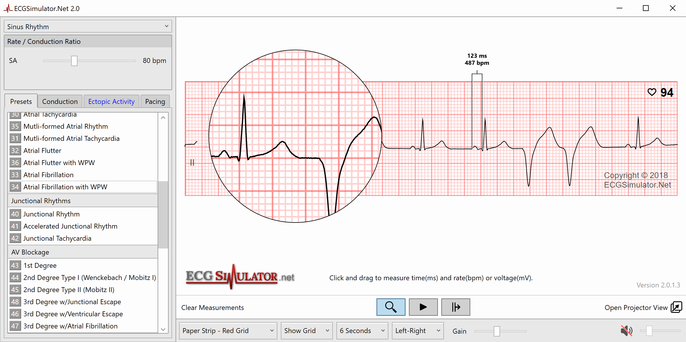 ECG Simulator - Heartbeat Simulation Software for Windows · GitHub