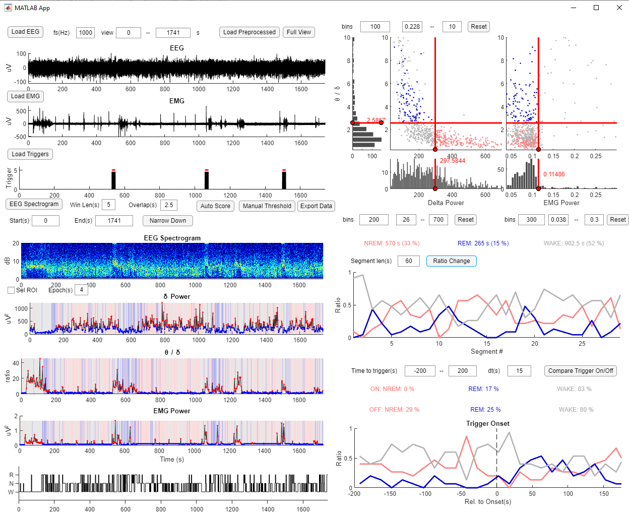 GitHub - li-shen-amy/eeg_sleep: MATLAB Code for Sleep cycle analysis ...