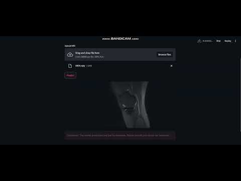 GitHub - ahmadafzal007/ACL-Ligament-Tear-Assessment-Model: This ...