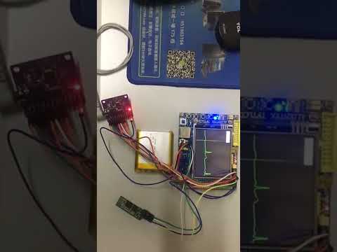 GitHub - felixcamer/electrocardiogram-system-using-stm32f103: This is ...