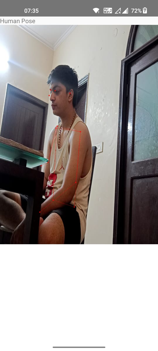 GitHub - Misterr-H/react-native-human-pose