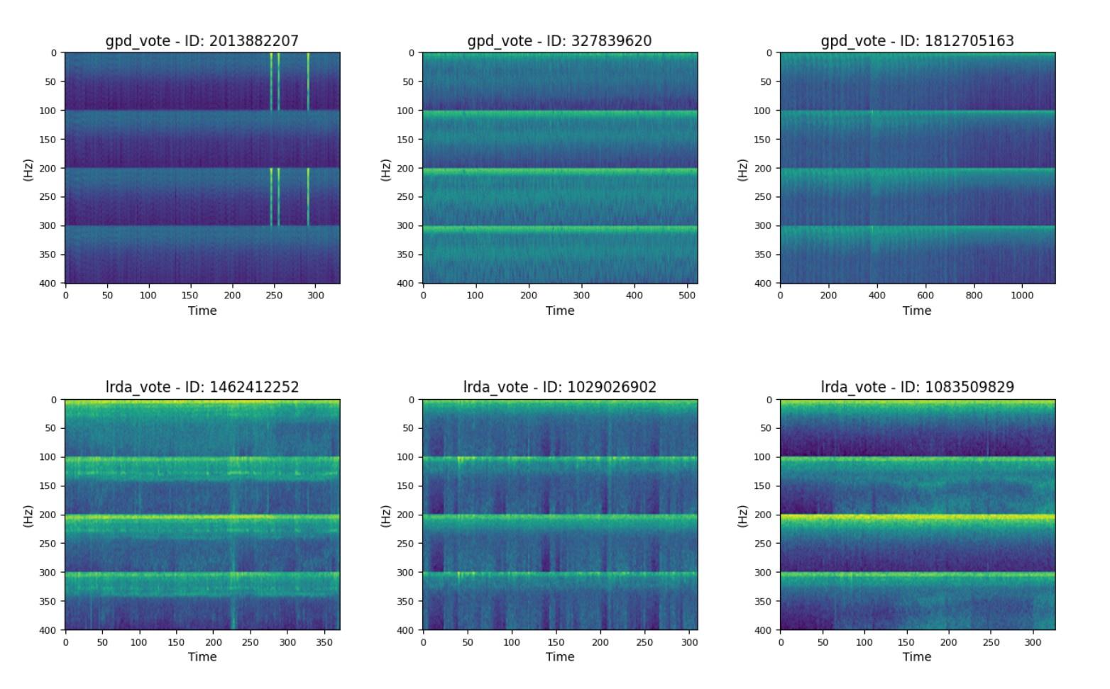 GitHub - sameena93/Harmful-Brain_Activity-Classification