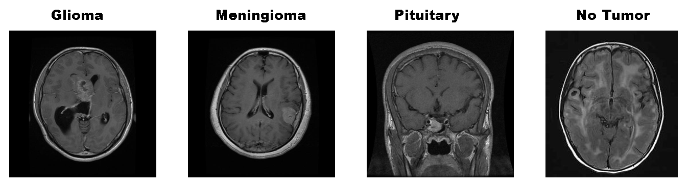 GitHub - wisdomml2020/brain_tumour_classification GitHub - wisdomml2020/brain_tumour_classification