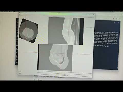 GitHub - guoyanzhongwgfufg/Dicom-Rotation-Viewer: This project is a multi-planar reconstruction ...