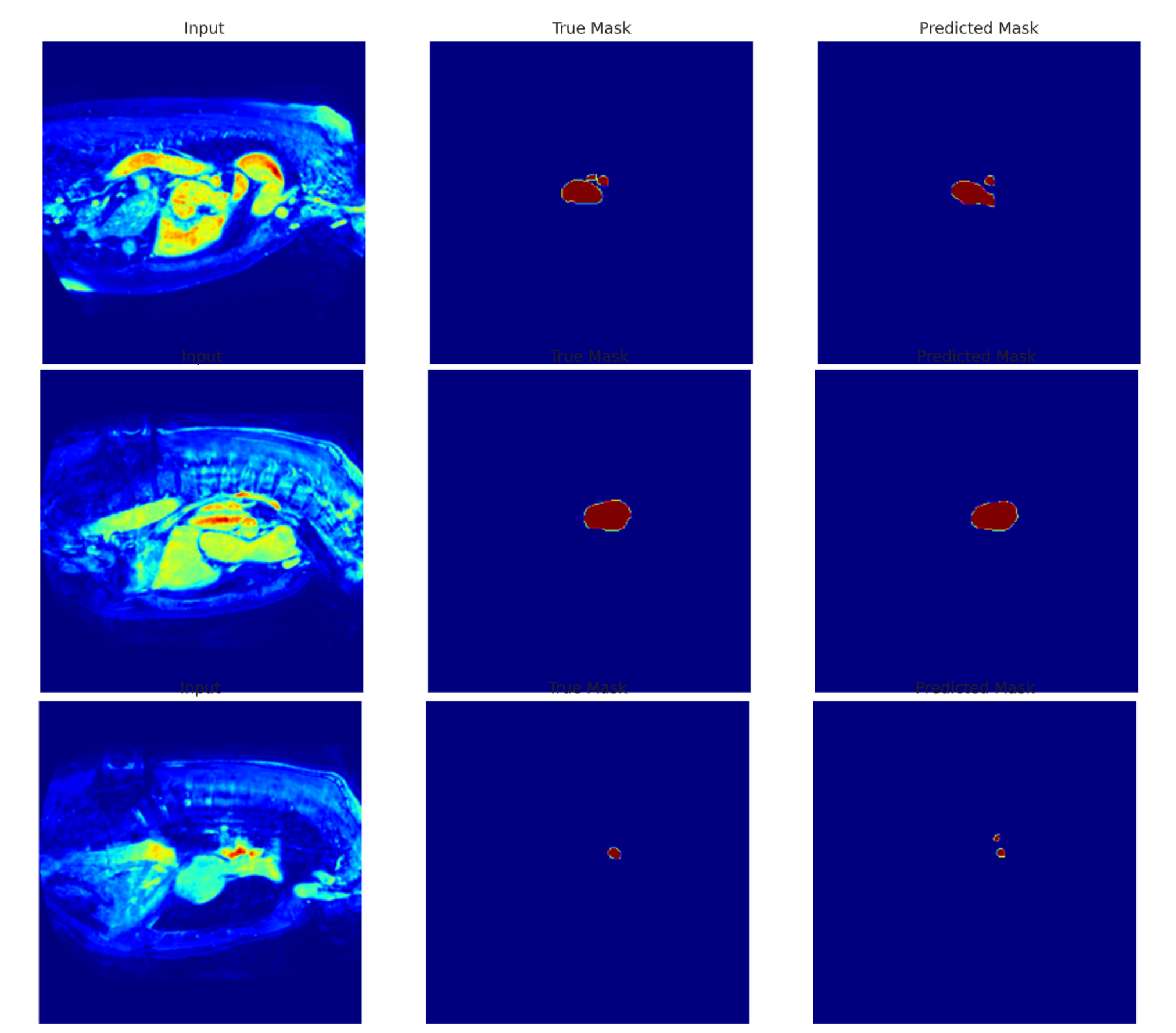 GitHub - ASEM000/UNet-Medical-Segmentation-Decathlon: UNet ... GitHub - ASEM000/UNet-Medical-Segmentation-Decathlon: UNet ...