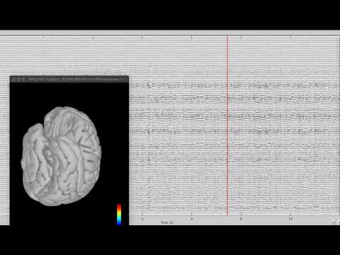 GitHub - chethanparameshwara/MindReading: Python/MATLAB Scripts to ...