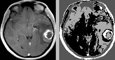 GitHub - AbhinavUtkarsh/Image-Segmentation: Image segmentation by KNN ...