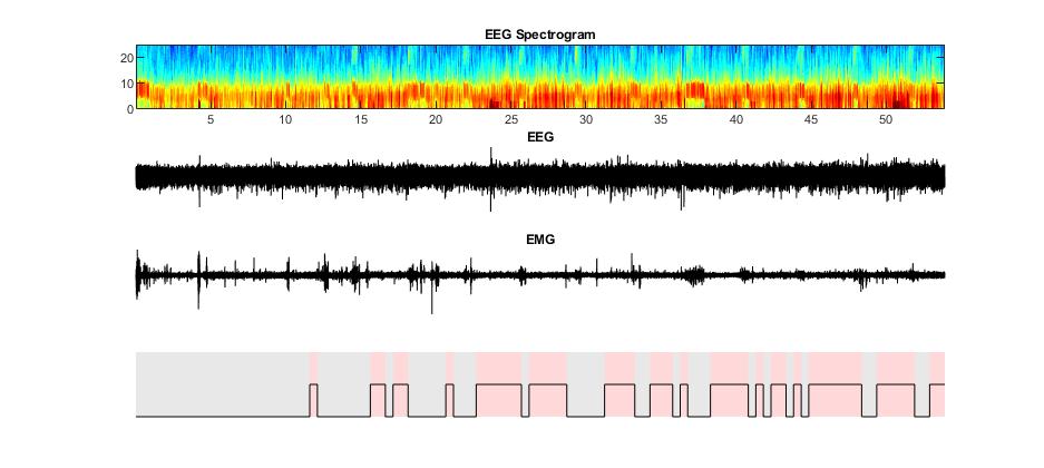 GitHub - li-shen-amy/eeg_sleep: MATLAB Code for Sleep cycle analysis ...