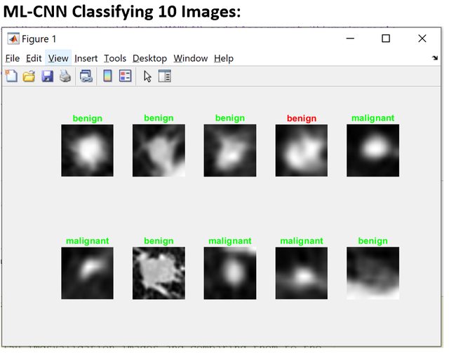GitHub - JMyers2292/Lung-Nodule-Classifier: MATLAB code used for leveraging pre-trained CNN's ...
