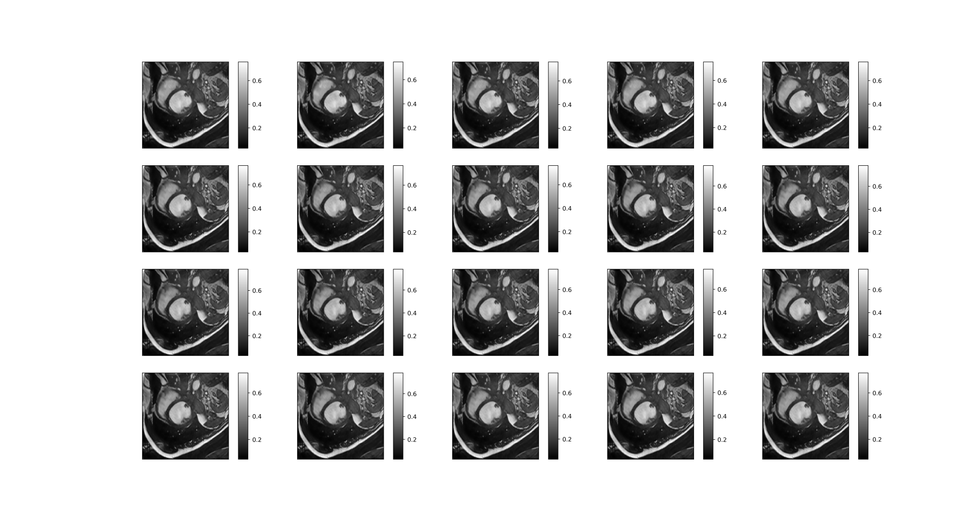 GitHub - 3b1b-sh/Deep_learning_Dynamic_MRI_Reconstruction: ShanghaiTech ...