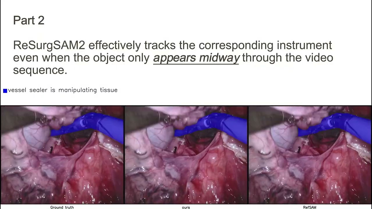 GitHub - jinlab-imvr/ReSurgSAM2: [MICCAI 2025] Official code implementation for paper ...