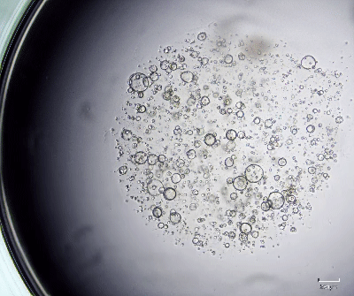 GitHub - duxuan11/Precision-Organoid-Segmentation-Technique-POST: segment any organoid (SAO)